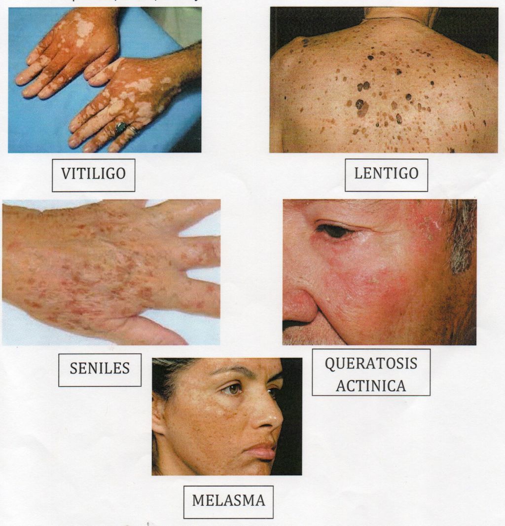 Máculas | Asociación Argentina de Masajistas